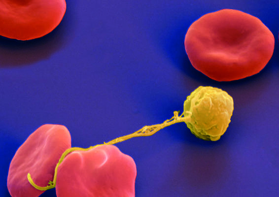 "Parasite Infections: From Experimental Models to Natural Systems ...